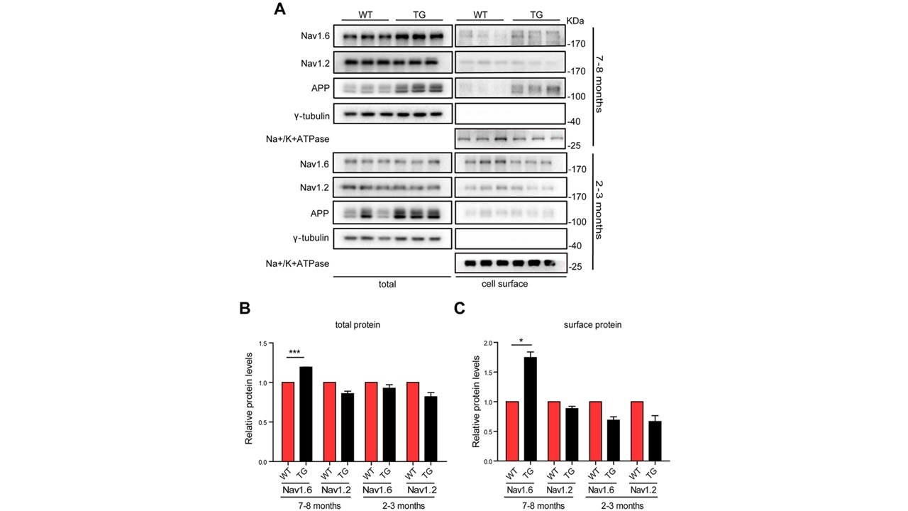 李韶/马全红团队揭示Nav1.6在阿尔茨海默病的作用机制_阿尔茨海默病