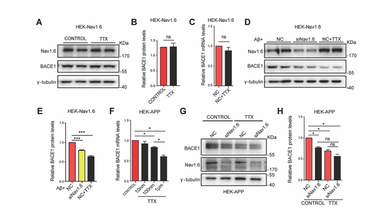 李韶/马全红团队揭示Nav1.6在阿尔茨海默病的作用机制_阿尔茨海默病