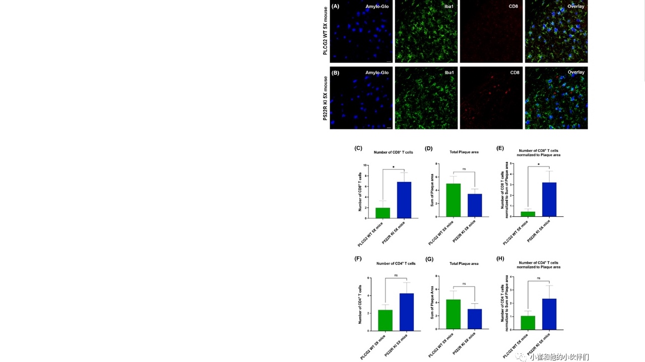 PLCG2突变通过促进小胶质细胞抗原呈递能力降低AD风险_阿尔茨海默病