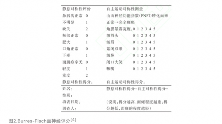 特发性面神经麻痹的临床评估与治疗_面神经炎
