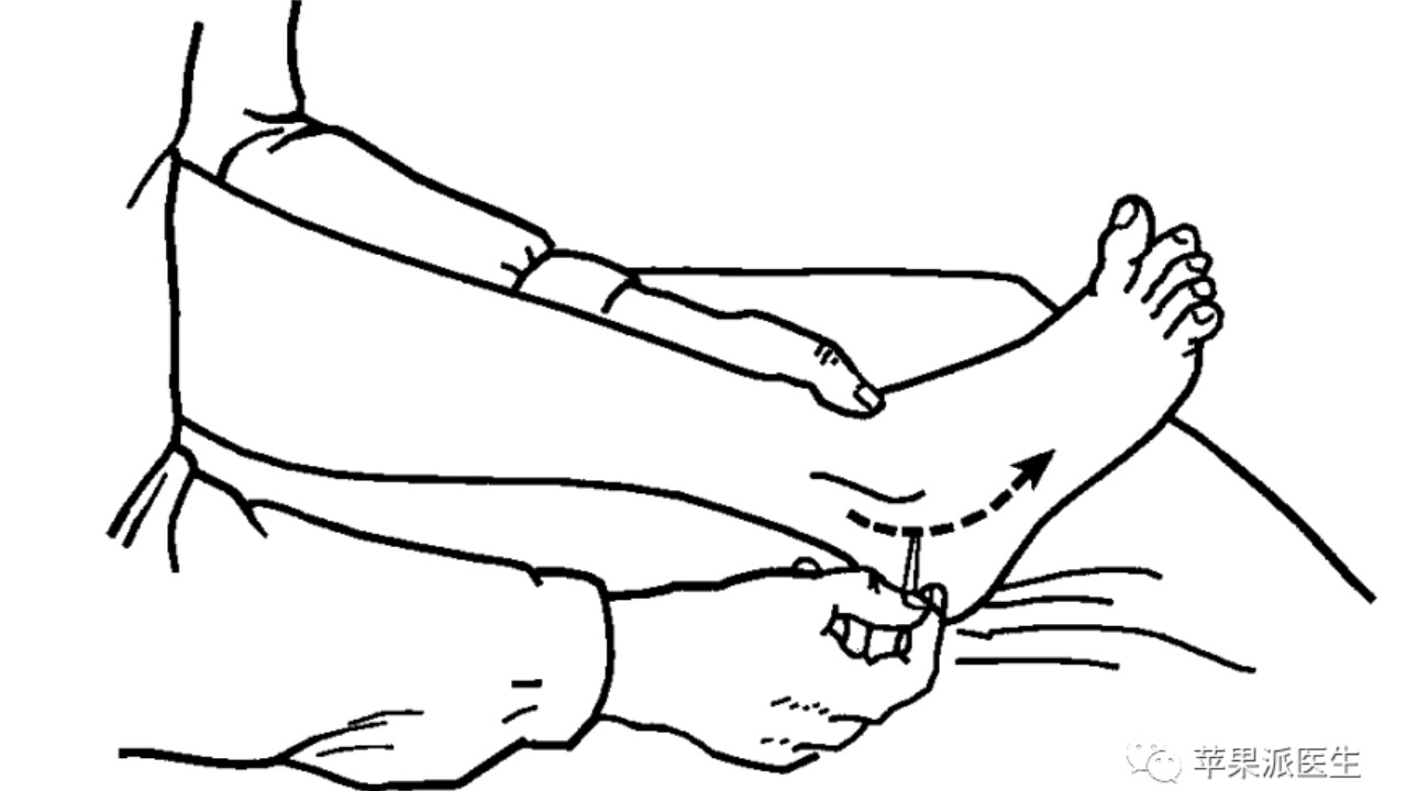 理解Babinski征，划对Babinski征_神经系统疾病
