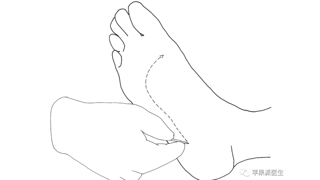 理解Babinski征，划对Babinski征_神经系统疾病