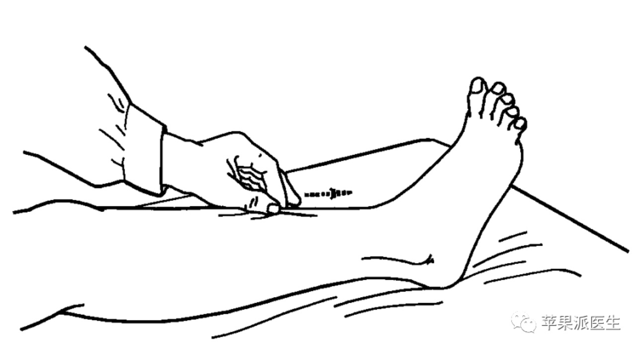 理解Babinski征，划对Babinski征_神经系统疾病