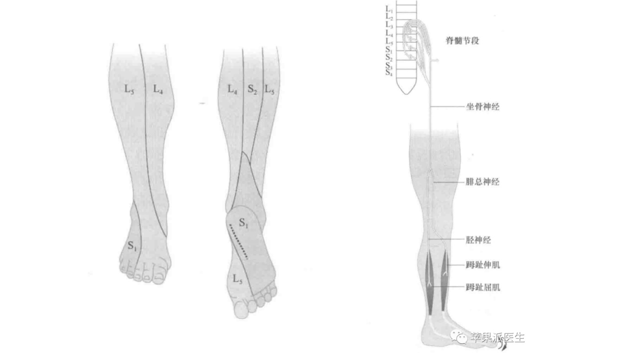 理解Babinski征，划对Babinski征_神经系统疾病