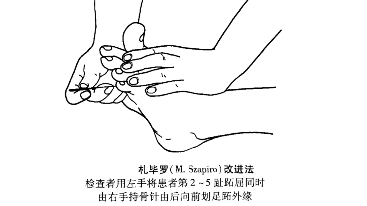 理解Babinski征，划对Babinski征_神经系统疾病